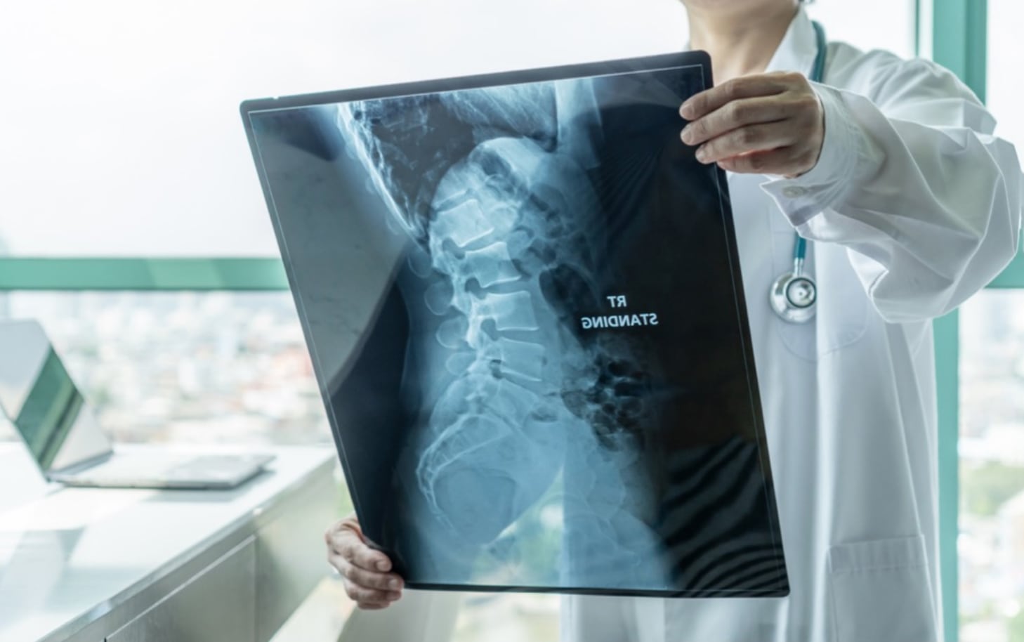 Using Artificial Intelligence Algorithms To Detect Vertebral Fractures Dr Jun S Kim